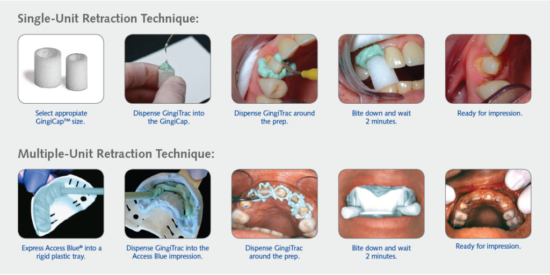 GingiTrac™ Cordless Gingival Retraction System! - Centrix